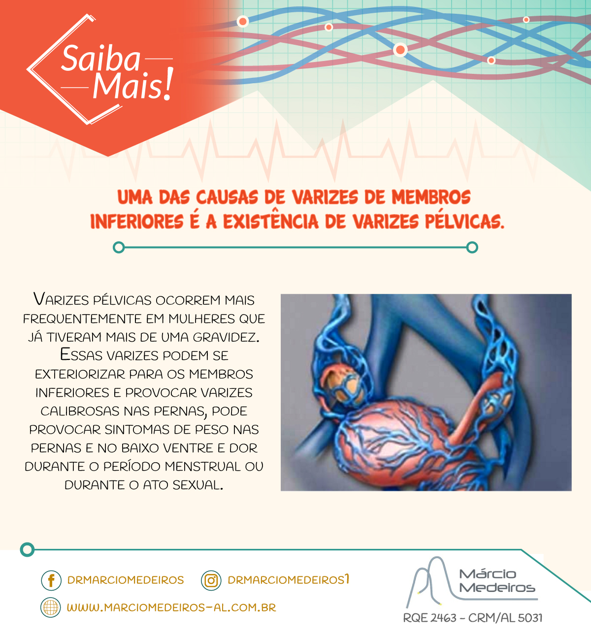 Uma das causas de Varizes de membros inferiores é a existência de ...